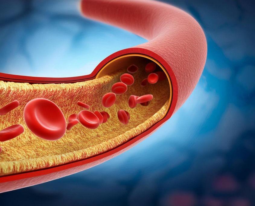 Cholesterin - Die Bedeutung der Werte